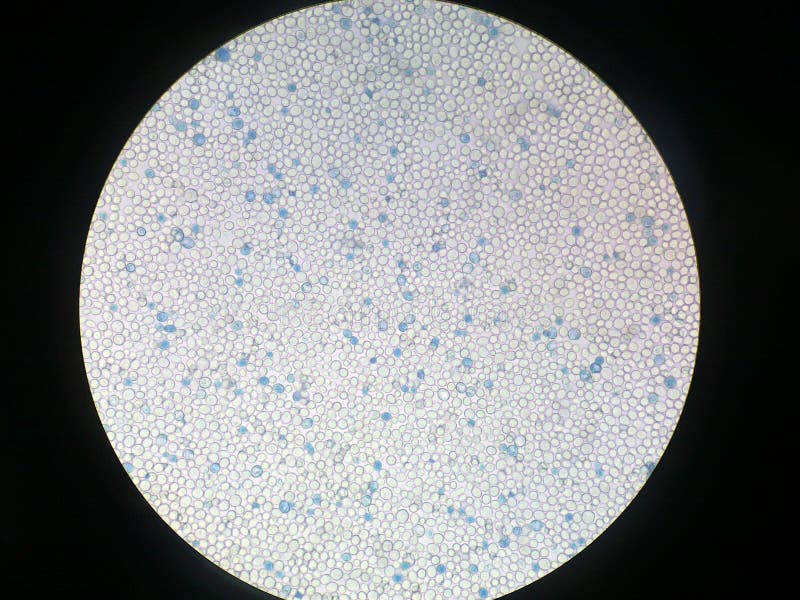 Levure image stock. Image of mortel, filamenteux, biologie - 23914635