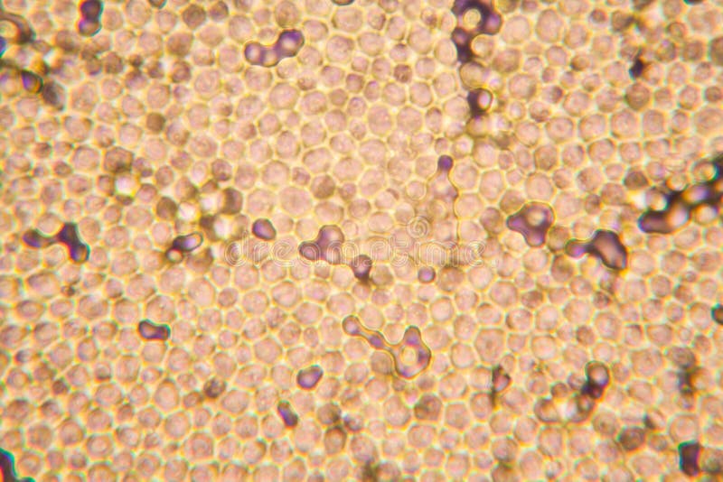 Levure au microscope photo stock. Image du cellule, microscope - 111147576