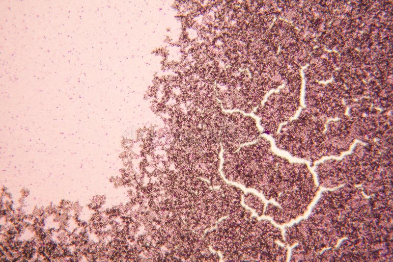 Levure au microscope image stock. Image du champignon - 111147599