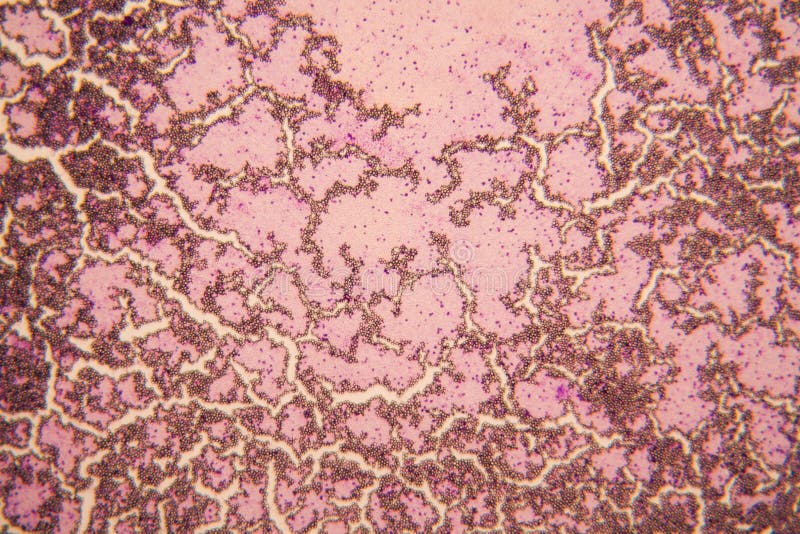 Levure au microscope image stock. Image du microscopique - 111147649