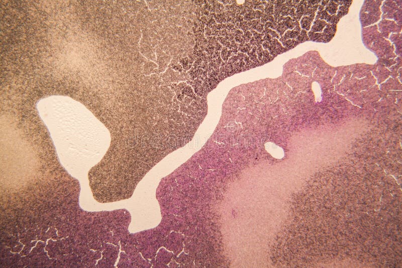 Levure au microscope image stock. Image du microscopique - 111147649