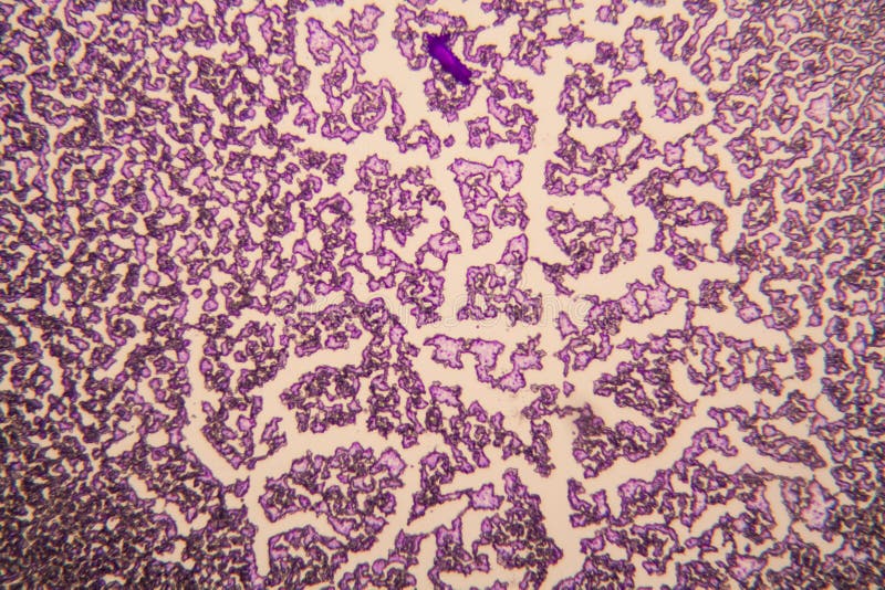 Levure au microscope image stock. Image du microscopique - 111147649