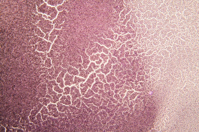 Levure au microscope image stock. Image du champignon - 111147599