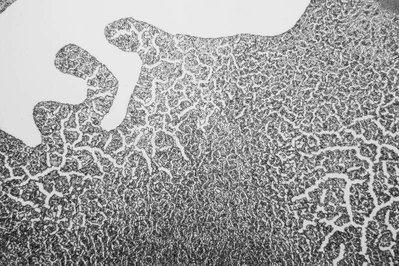 Levure au microscope image stock. Image du microscopique - 111147649