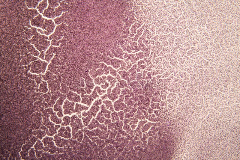Levure au microscope image stock. Image du microscopique - 111147649