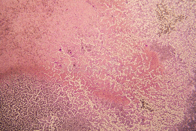 Levure au microscope image stock. Image du microscopique - 111147649