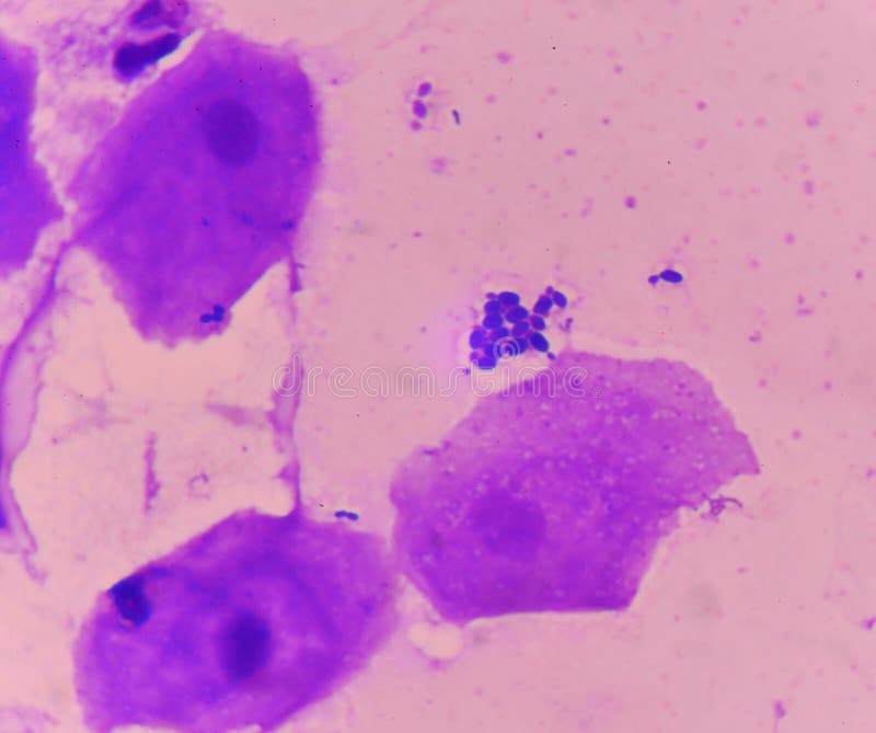 Cellules De Levure De Bourgeonnement Avec Des Pseudohyphae Image stock ...