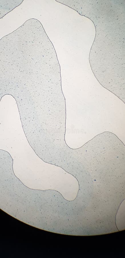 Levure sous le microscope image stock. Image du levure - 26710125