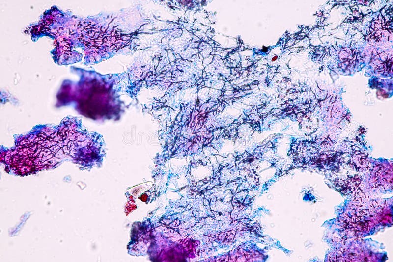 Lichen, Hyphae and Symbiotic Algae Under the Microscope for Education ...