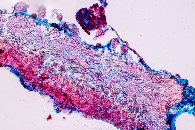 Lichen, Hyphae and Symbiotic Algae Under the Microscope for Education ...