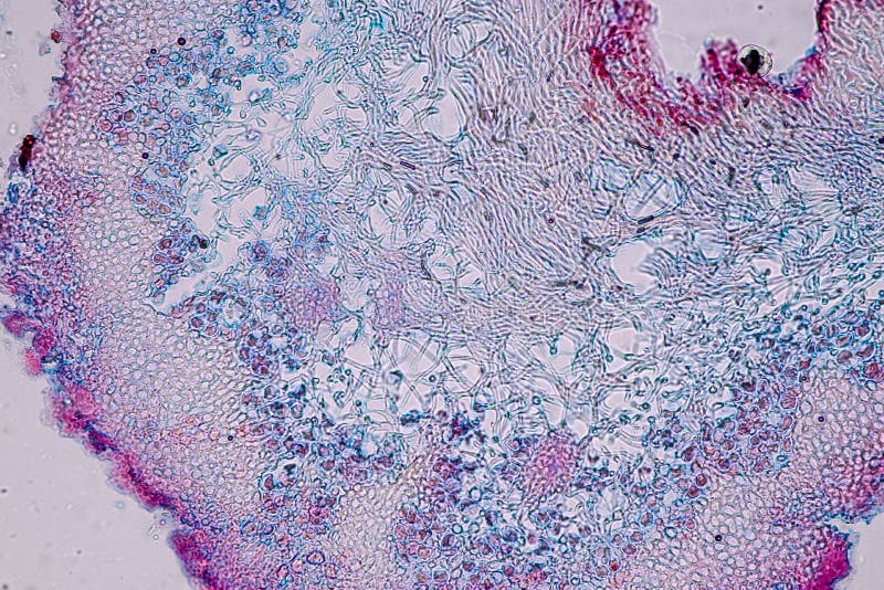 Crustose Lichen Under Microscope Stock Photos - Free & Royalty-Free ...