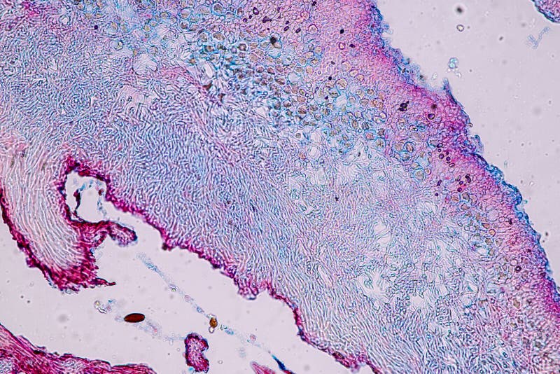 Lichen, Hyphae and Symbiotic Algae Under the Microscope for Education ...