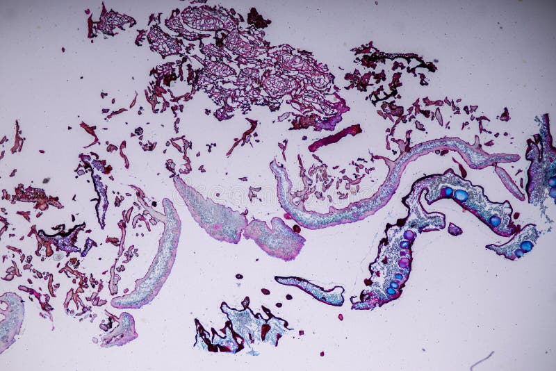 Lichen, Hyphae and Symbiotic Algae Under the Microscope for Education ...