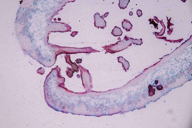 Lichen, Hyphae and Symbiotic Algae Under the Microscope for Education ...