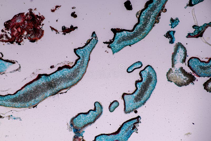 Lichen, Hyphae and Symbiotic Algae Under the Microscope for Education ...