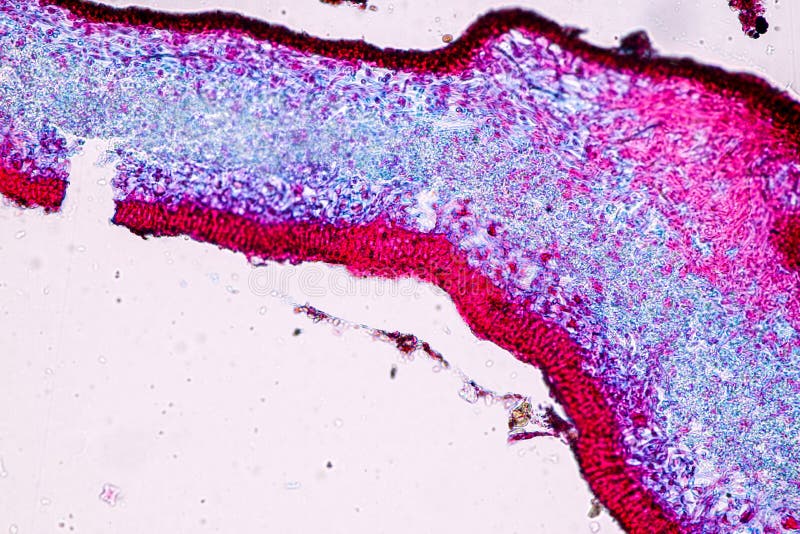 Crustose Lichen Under Microscope Stock Photos - Free & Royalty-Free ...