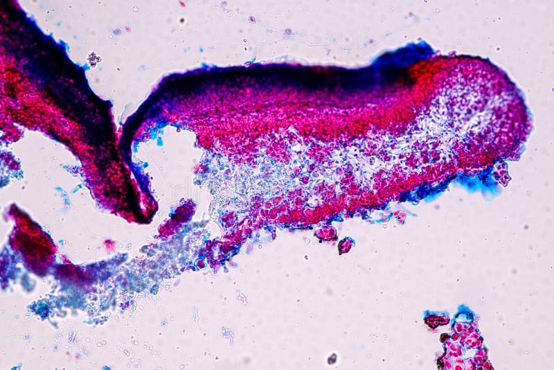 Lichen, Hyphae and Symbiotic Algae Under the Microscope for Education ...