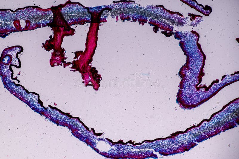 Lichen, Hyphae and Symbiotic Algae Under the Microscope for Education ...