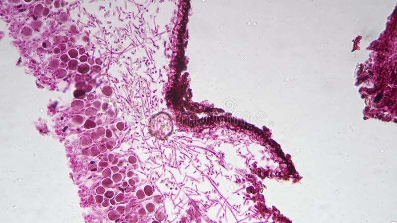 Lichen Section Under Microscope 400x for Educational Issues and ...
