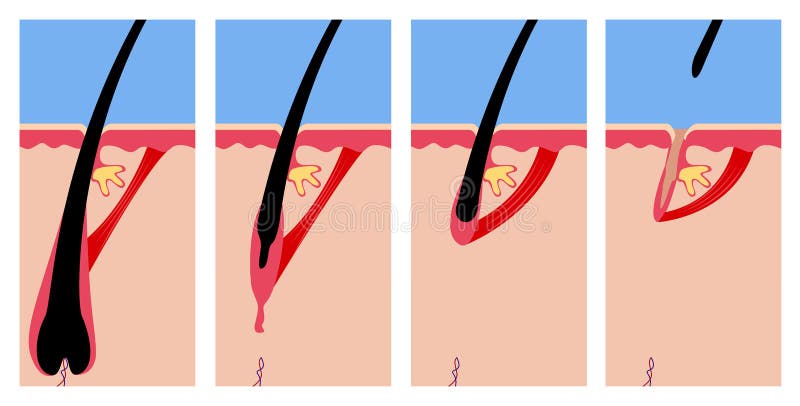 Life cycle of hair fall stock vector. Illustration of procedure - 102759728