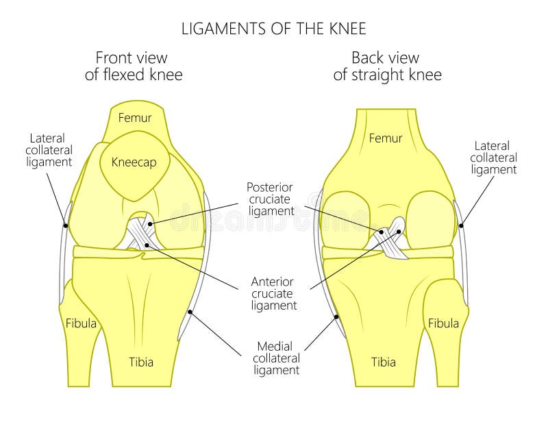 Ligament Av Det Knee_Tear Av Den Mediala Parallella Ligamentet Vektor ...