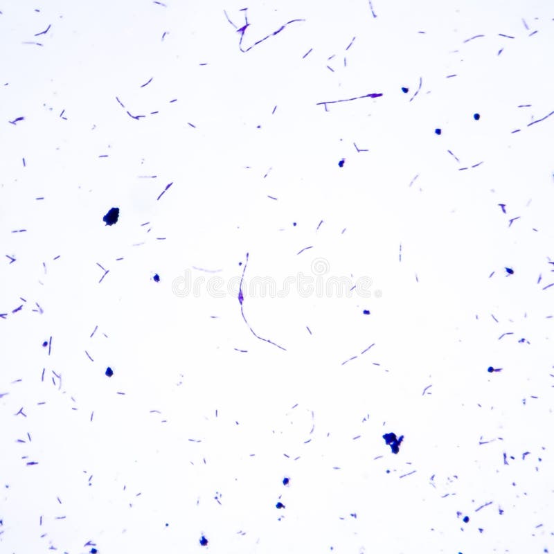 Bacillus Gram Positive Stain Under Microscope View. Bacillus is Rod ...