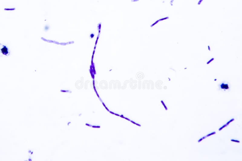 Gram Positive Diplobacilli