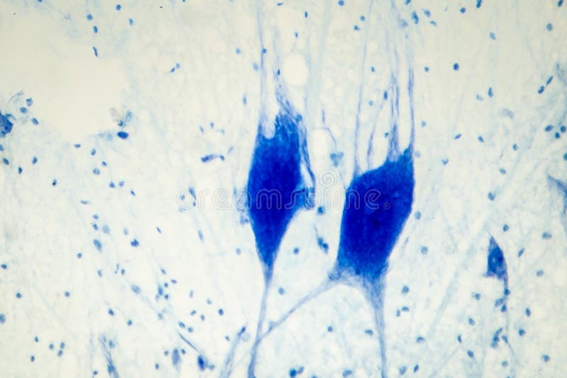 Light Micrograph of Human Brain Tissue Stock Image - Image of nuclear ...