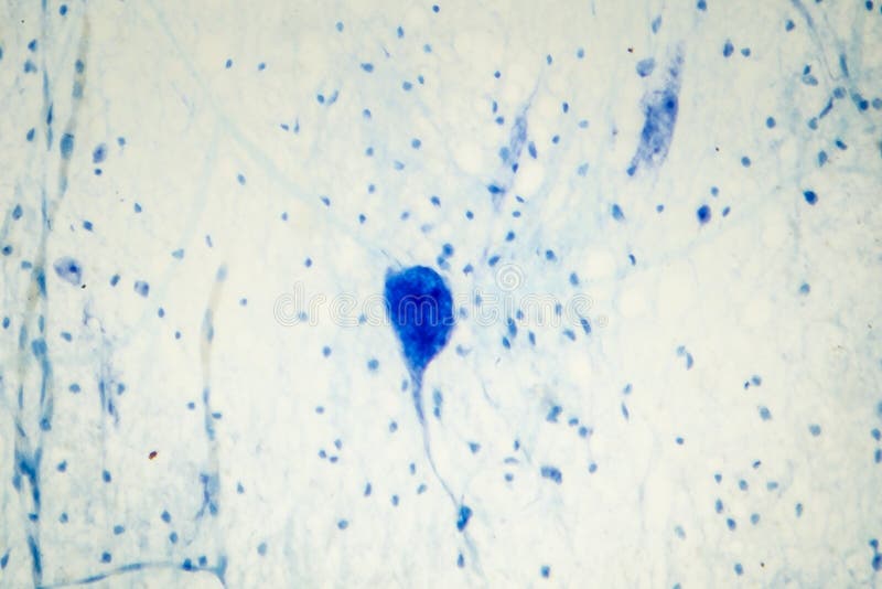 Light Micrograph of Human Brain Tissue Stock Photo - Image of ...