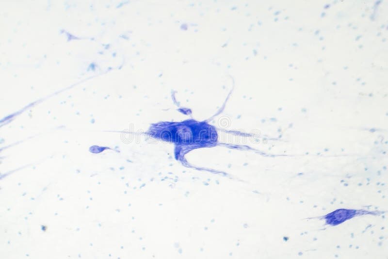 Light Micrograph of Human Brain Tissue Stock Image - Image of ...