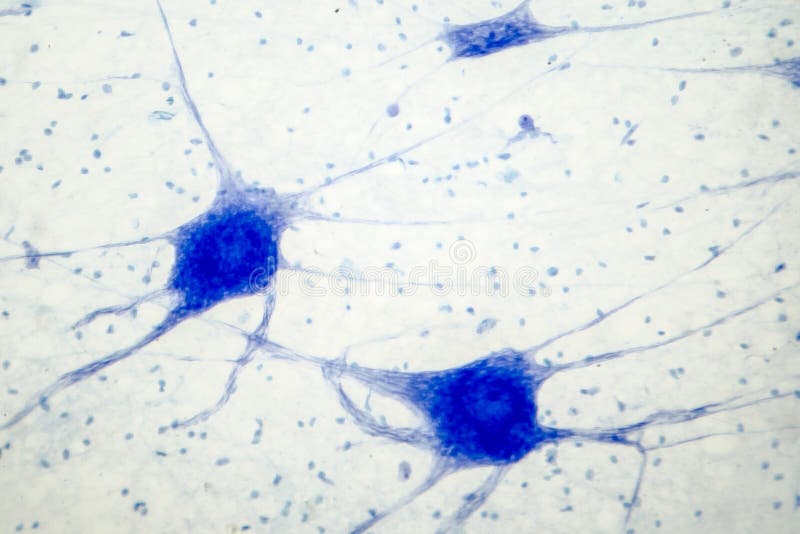 Healthy Brain Tissue