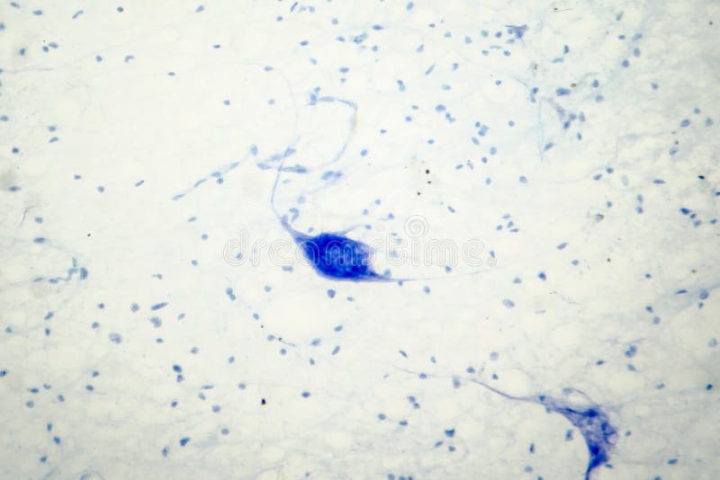 Micrograph of Human Cerebrum 400x Magnification Stock Photo - Image of ...