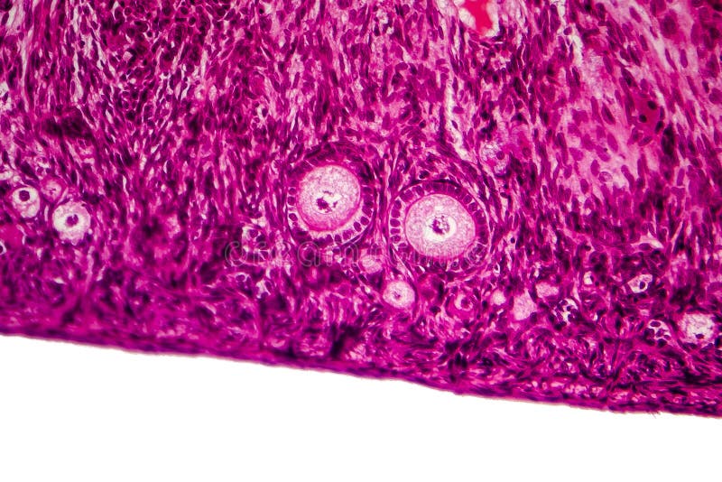 Light Micrograph of Human Ovary Stock Image - Image of ovarian ... Light Micrograph of Human Ovary Stock Image - Image of ovarian ...