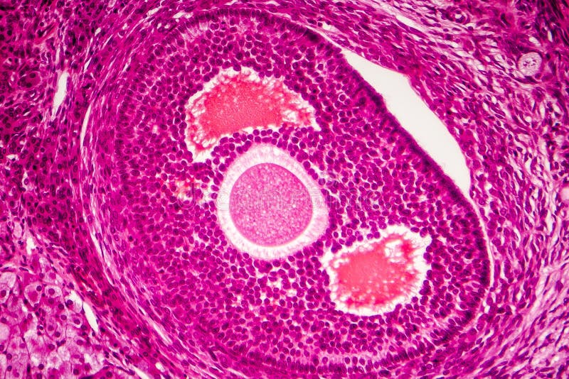 Light Micrograph of Human Ovary Stock Photo - Image of primordial ... Light Micrograph of Human Ovary Stock Photo - Image of primordial ...