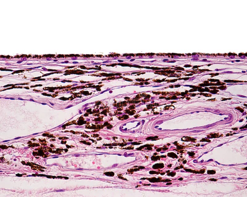 Eye. Choroid stock photo. Image of human, histology - 303600358