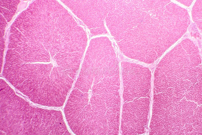 Light Micrograph of a Liver Stock Photo - Image of tissue, hematoxylin ...