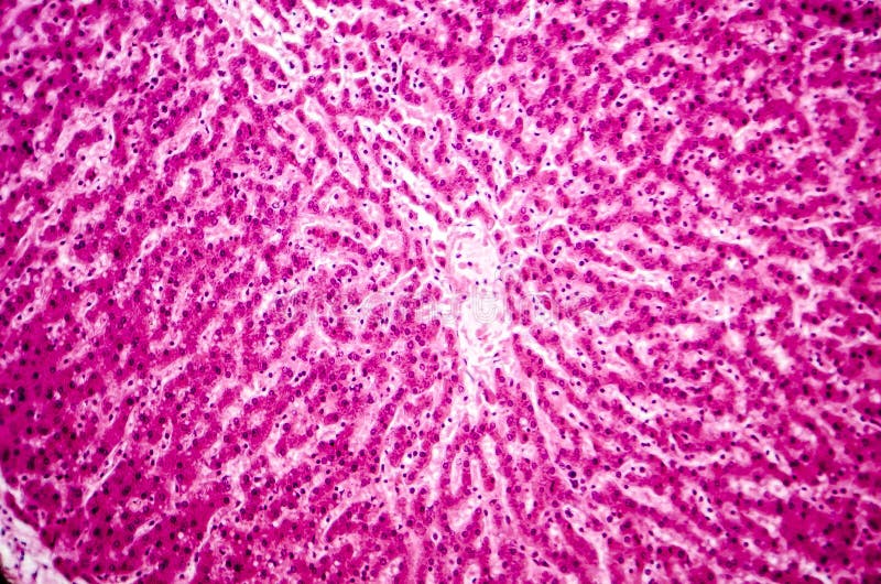 Light Micrograph of a Liver Stock Image - Image of hepatocyte ...