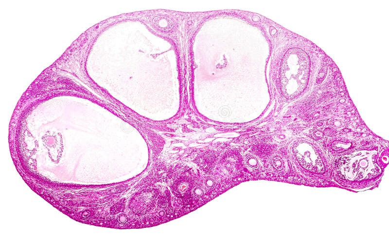 Light micrograph of ovary stock photo. Image of secondary - 77845892