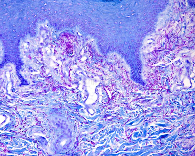 Human Skin. Dermis Papillar. Elastic Fibers Stock Image - Image of ...