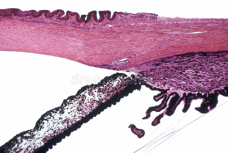 Human Eye. Ciliary Body and Iris Stock Photo - Image of stratified ...