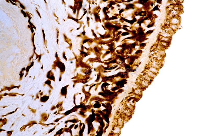 Iris melanin stock photo. Image of micrograph, eyeball - 303600134