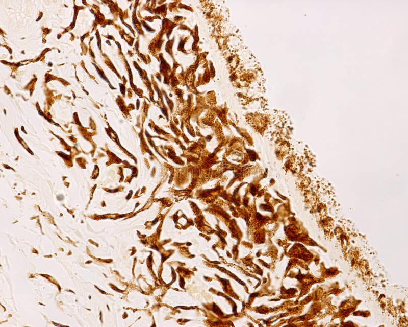 Iris melanin stock photo. Image of dilator, epithelium - 303600652