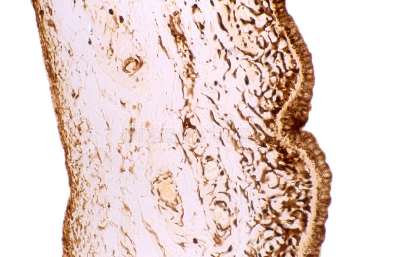 Iris melanin stock image. Image of histological, melanin - 303600135