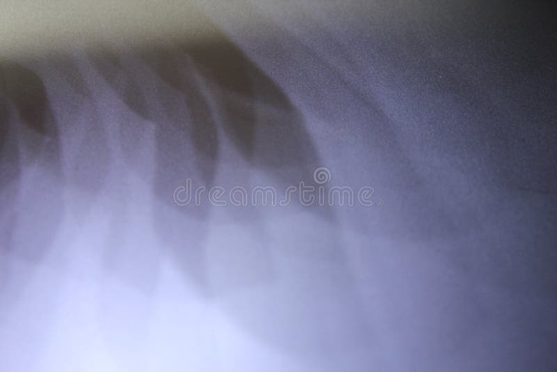 Light Shading, Intensity on Silver Background Stock Image - Image of ...