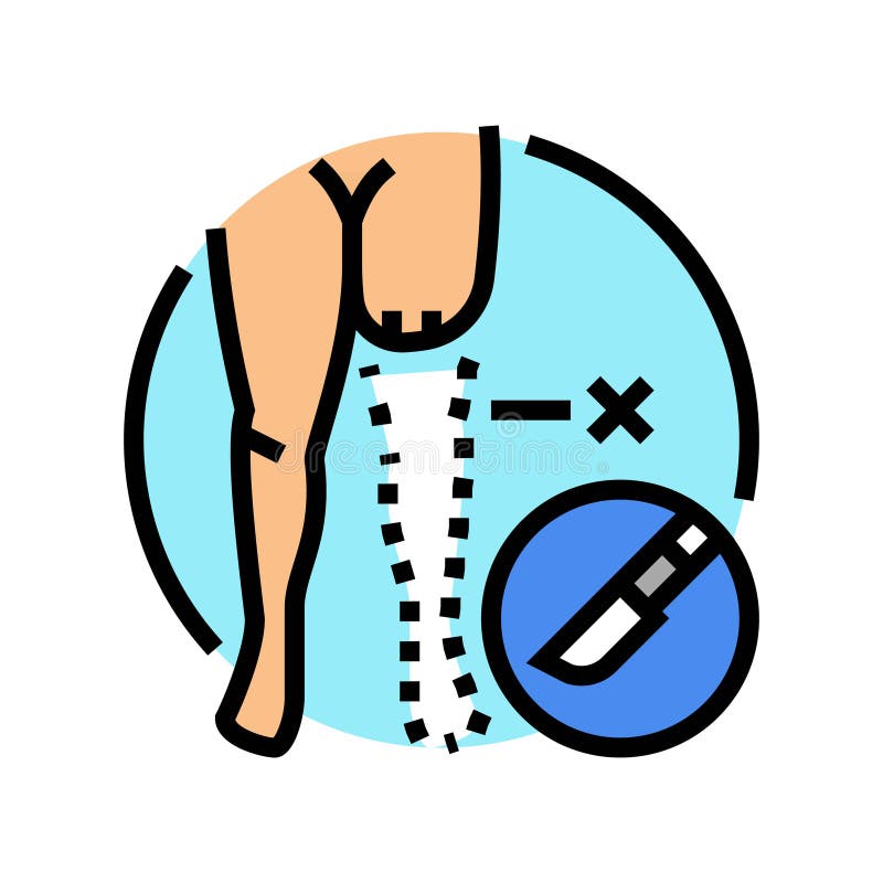 Limb Amputation Surgery Color Icon Vector Illustration Stock ...