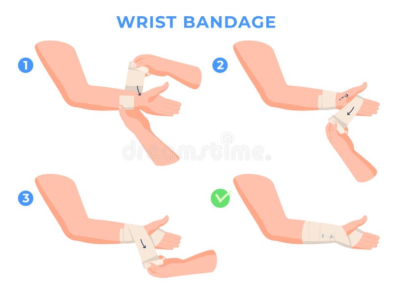 Limb Bandaging Step-by-step Instructions. Help with Hand Injuries ...