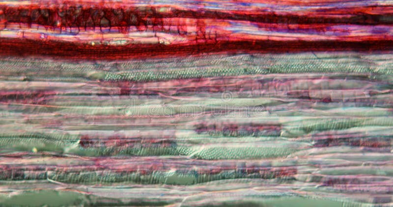 Longitudinal Section of Human Being Nerves Trunk Under Microscope 200x ...