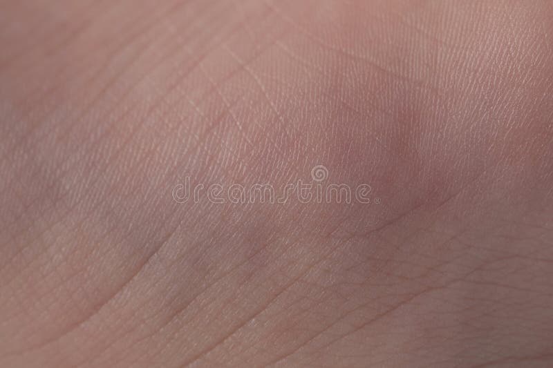 Lines on human skin stock image. Image of detail, dermatology - 255567819