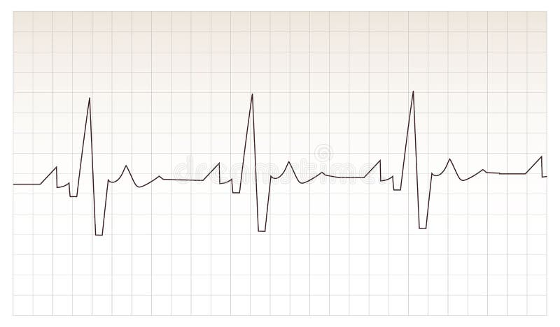 Linha de vida ilustração stock. Ilustração de forma, circunstância ...