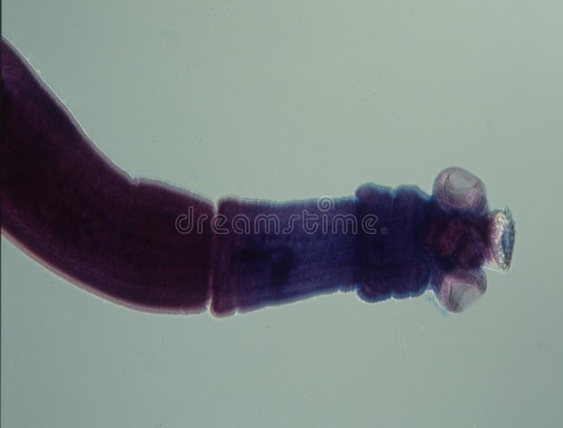 Lintworm - Cestoda - Zijaanzicht Stock Foto - Image of monster ...
